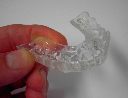 Splints - Rodwell Orthodontic Laboratory - ComfiFit