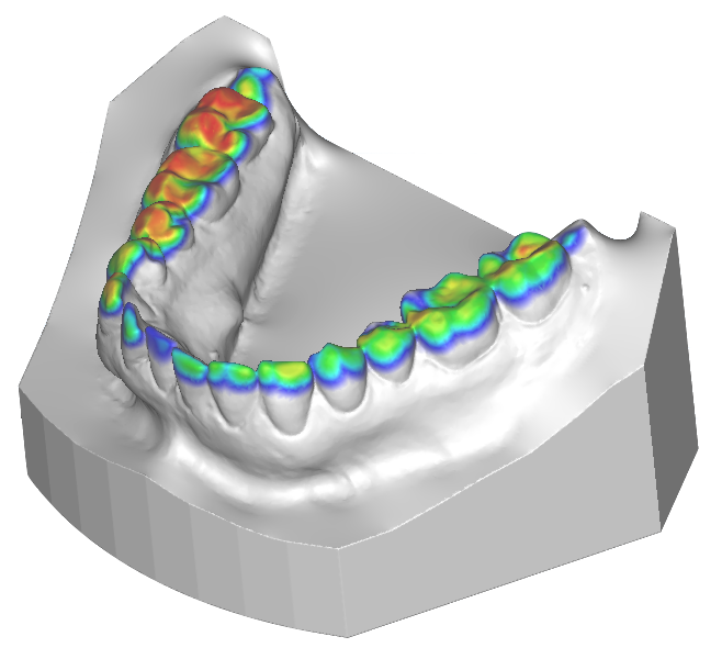 eDontics - Digital Study Models - Rodwell Orthodontic Laboratory